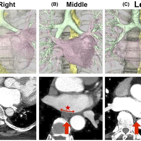 Anatomical Classification Of The Esophagus The Images Above Are Download Scientific Diagram