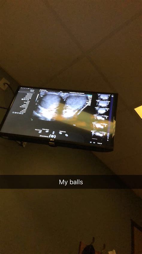 Was Worried Ultrasound Of My Testicles Album On Imgur