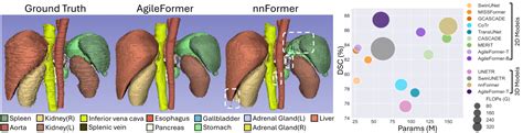 [论文审查] Agileformer Spatially Agile Transformer Unet For Medical Image Segmentation