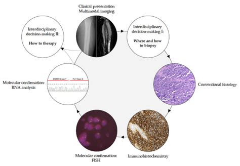 Schematic Diagnostic Workflow Of Ews And Related Entities Download