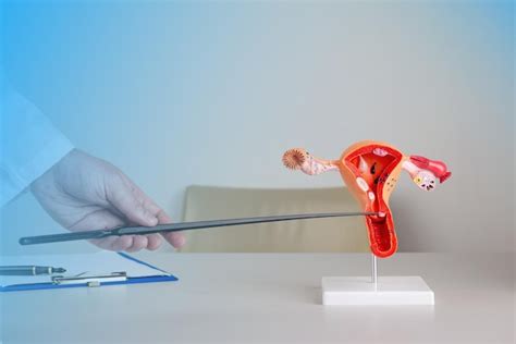 그의 바탕 화면에 여성 생식 기관의 의사 산부인과 의사 가리키는 모델 프리미엄 사진