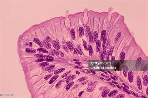 Simple Columnar Epithelium And Many Goblet Cells Covering A Villus In The Small Intestine 100x