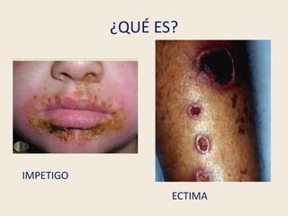 Actualización En El Tratamiento De Las Infecciones De La Piel Y Partes