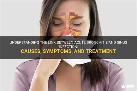 Understanding The Link Between Acute Bronchitis And Sinus Infection