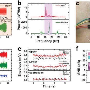 Dualsensorbased Motion Artifact Cancellation Scheme A Raw And Download Scientific Diagram