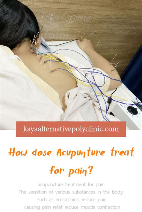 Acupuncture Pain Relief Kaya Alternative Polyclinic