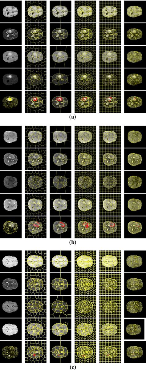 The Segmentation Results Under Different Methods Are In Three Groups Of Download Scientific