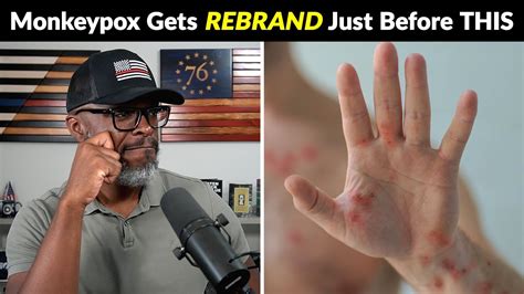 Monkeypox Gets WEIRD REBRAND Just In Time For THIS Month YouTube
