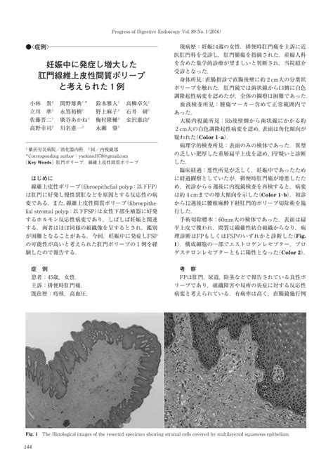 Pdf A Case Of Fibroepithelial Stromal Polyp Of The Anus Rapidly