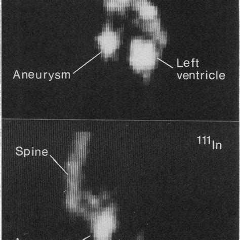 Simultaneously Acquired Computer Reconstruction Images In The Same Download Scientific Diagram
