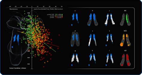 Results From The Vbm Multivariate Linear Regression Analyses Performed
