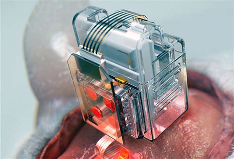 Soft Neural Implant Allows Scientists To Manipulate Brain Cells Via Smartphone