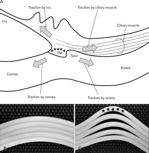Diagrams Showing Hypothetical Induction Of Trabecular Meshwork Download Scientific Diagram