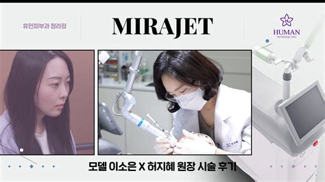 지혜로운피부 특별편 피부재생 흉터치료에 도움을주는 미라젯쥬베룩 시술 콜라겐의 재생을 도와줘요 🥰 Youtube