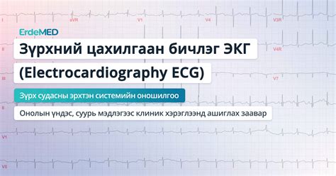 Зүрхний цахилгаан бичлэг ЭКГ Electrocardiography Ecg Erdemed