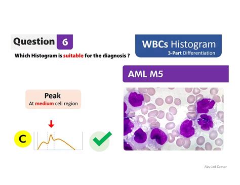 Wbc Histogram Pdf