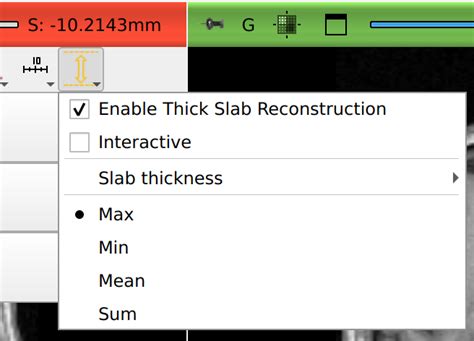 new feature thick slab reconstruction from slice controllers and views