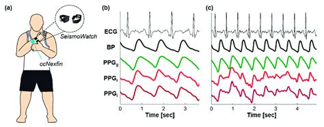 Example Ppg Signals Taken Together With Electrocardiogram Ecg And Bp