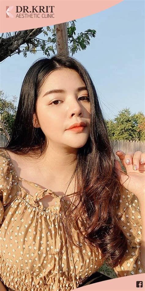 ปัญหา 🙅คางสั้น 🙅คางตัด 🙅คางถอย Dr Krit Aesthetic Clinic