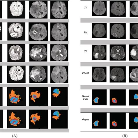 Segmentation Results Of The Proposed ShuffledYOLO Network For A Download Scientific Diagram