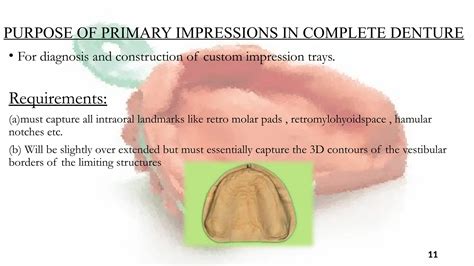 Primary Impression In Complete Denturepptx