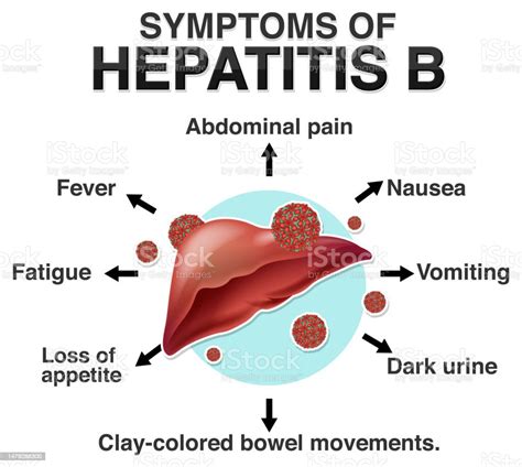 Vetores De Sintomas Informativos Da Hepatite B E Mais Imagens De Hepatite B Hepatite B
