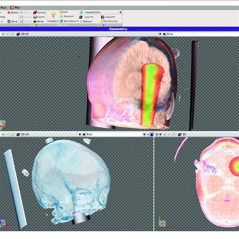 Classic Surface Based Visualization Of A Voxelized Phantom And Dose Download Scientific