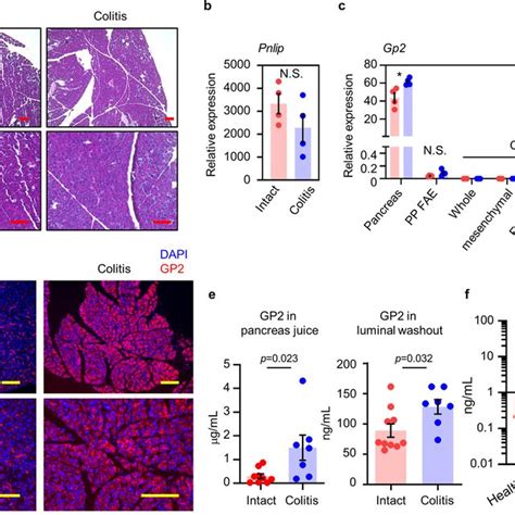 Treatment Algorithm For Segmental Colitis Associated With Diverticulosis Download Table