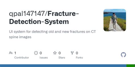 GitHub Qpal Fracture Detection System UI System For Detecting Old And New Fractures On