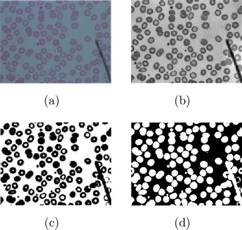 Figure 1 From Red Blood Cell Segmentation With Overlapping Cell Figure 1 From Red Blood Cell Segmentation With Overlapping Cell
