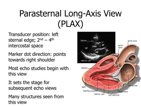 Ppt Introduction To Echocardiography Cardiac Ultrasound Powerpoint