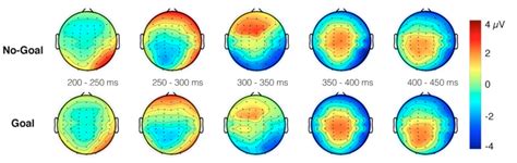 Scalp Topographies For Each Condition At The Time Intervals Indicated