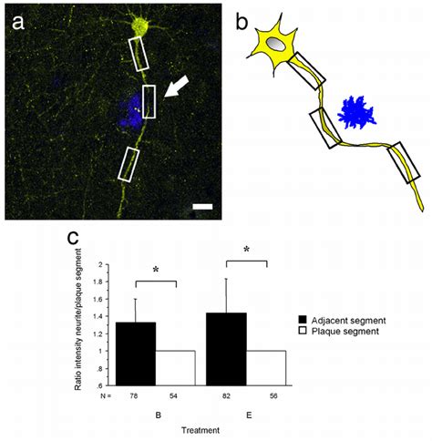Individual Dendritic Segments In Close Proximity To A Plaque Have