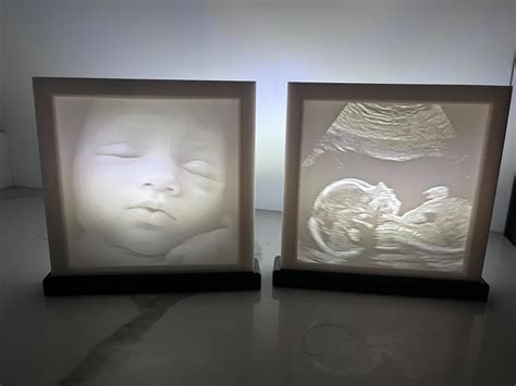 3d Printed Ultrasound Photo Lithophane Nightstand Lamp Comes With Led