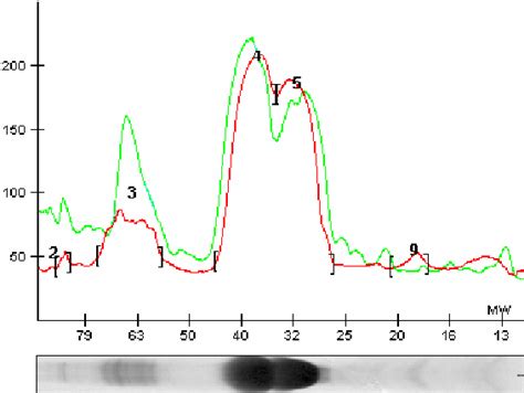 Electrophoretic Separation Of Casein Fractions After Subjecting To