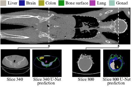 Figure 1 From Whole Body Multi Organ Segmentation Using Anatomical