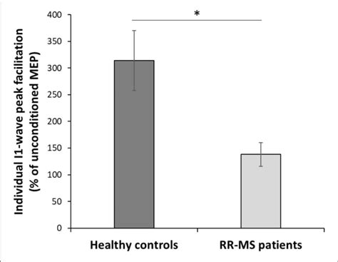 Short Intracortical Facilitation Sicf Individual Most Effective