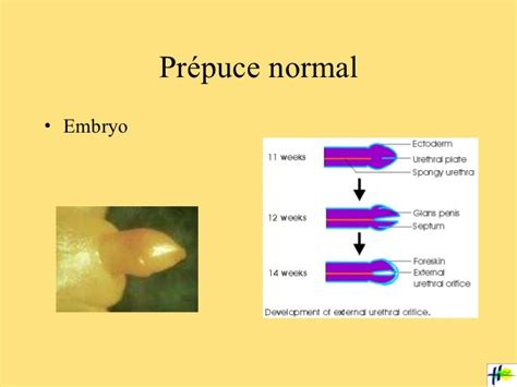 Prépuce Définition Médicale Prépuce Symptômes Iogk