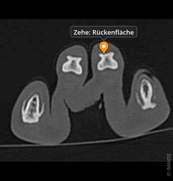 Zehe Rückenfläche Vet Anatomy Imaios