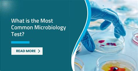 What Is The Most Common Microbiology Test Lifecare Hospitals
