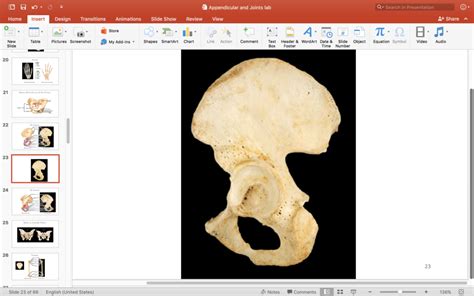 Os Coxae Diagram Quizlet