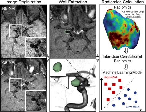 Radiomics Feature Extraction Using The Registered Nonenhanced Magnetic