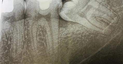 Imgur The Magic Of The Internet