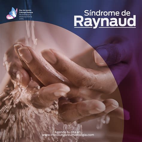 Síndrome De Raynaud La Enfermedad De Raynaud Causa Que Algunas Zonas