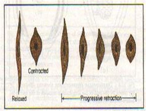 MBBS Medicine Humanity First Normal Labour