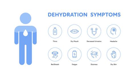 820 Dehydration Infographic Stock Illustrations Royalty Free Vector