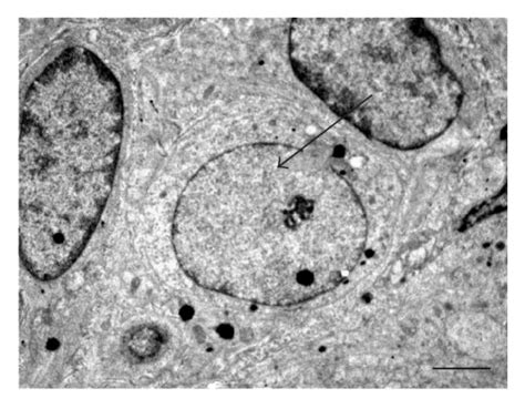 High Magnification Light Microscopy Pictures Of Toluidine Blue Stained