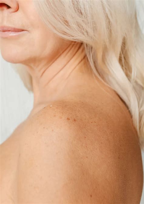 Ablative Vs Non Ablative Laser Resurfacing Which One Is Right For You