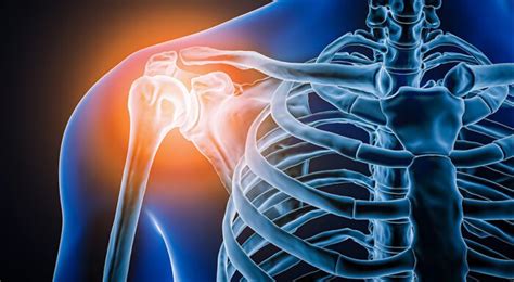 First Surgery With Zimmer Biomet Rosa Shoulder System Orthoworld