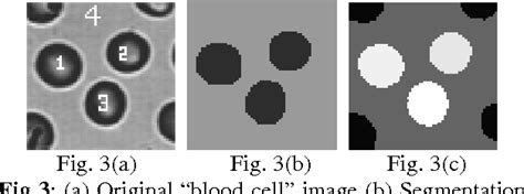 Figure 1 From Segmentation Of Images Using Level Set Analysis Semantic Scholar